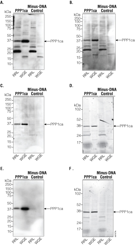 Non-Radioactive Detection of Proteins Expressed in Cell-Free Expression ...